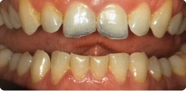 Family (General) Dentistry | Treatments | The Priestgate Clinic