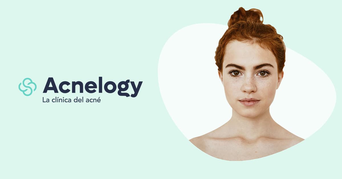 Acnelogy | Tratamientos personalizados para tu piel