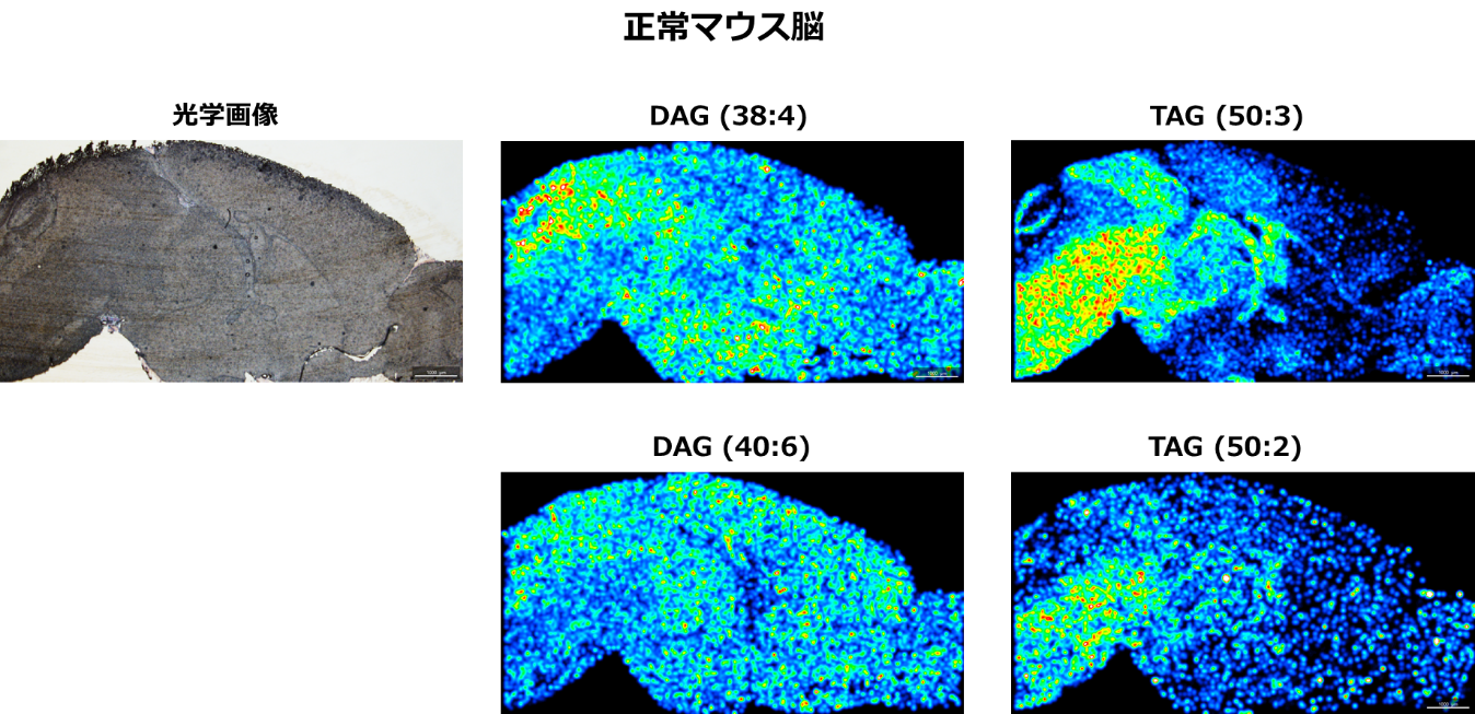 DAG ・ TAGスキャン(ジアシルグリセロール・トリアシルグリセロールスキャン)