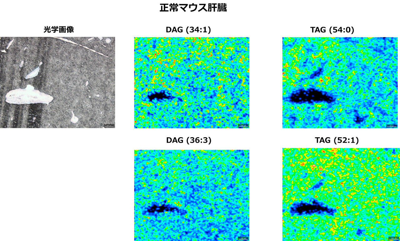 DAG ・ TAGスキャン(ジアシルグリセロール・トリアシルグリセロールスキャン)