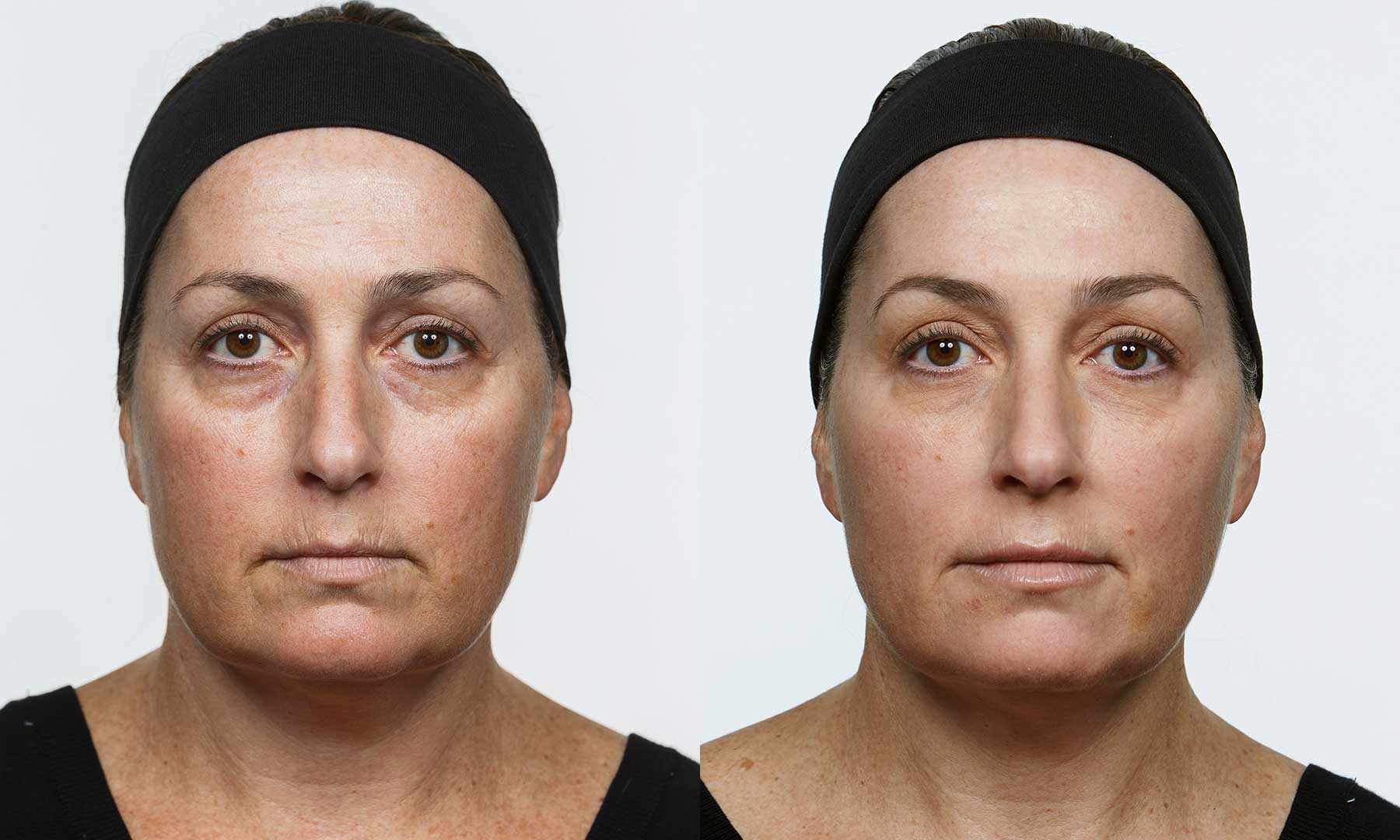 Cosmetic, Medical And Surgical Dermatology Clinic | Dermetics