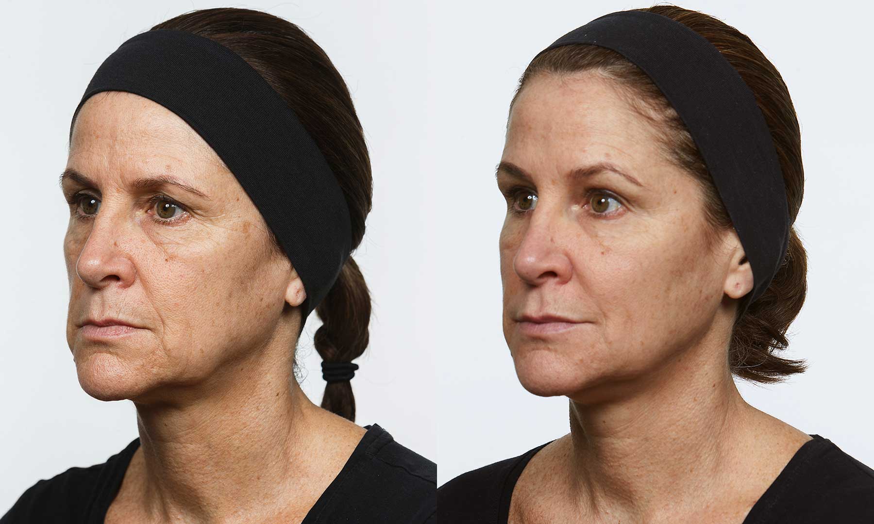 Cosmetic, Medical And Surgical Dermatology Clinic | Dermetics