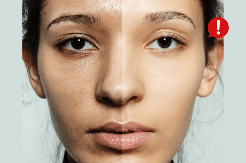 Deceptive Marketing - Dermetics