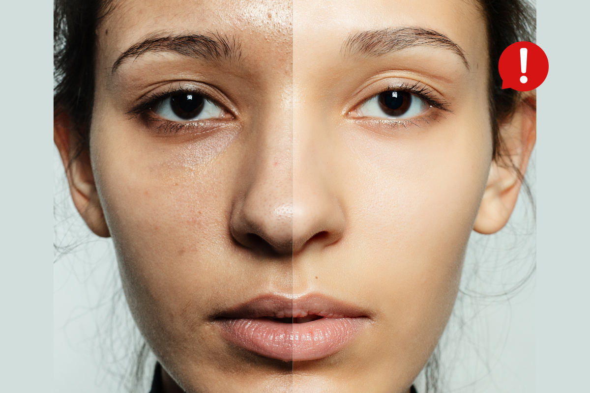 Deceptive Marketing - Dermetics