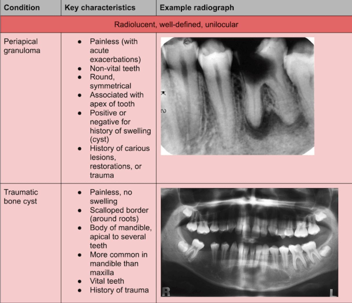 Radiographic Bone Lesions To Know for the INBDE | INBDE Bootcamp