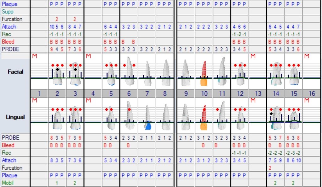 Perio Classification for the INBDE | INBDE Bootcamp