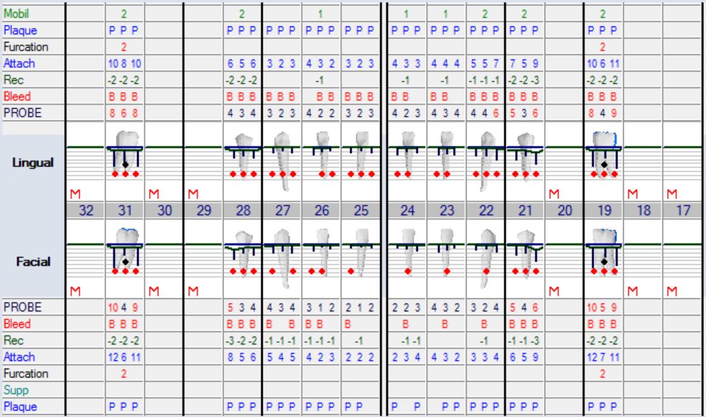 Perio Classification for the INBDE | INBDE Bootcamp