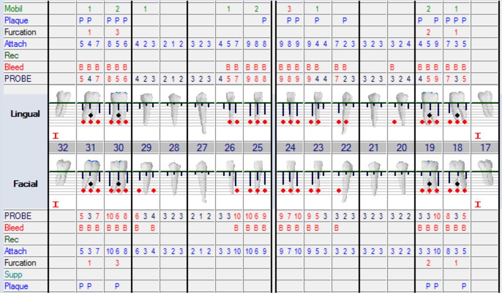 Perio Classification for the INBDE | INBDE Bootcamp