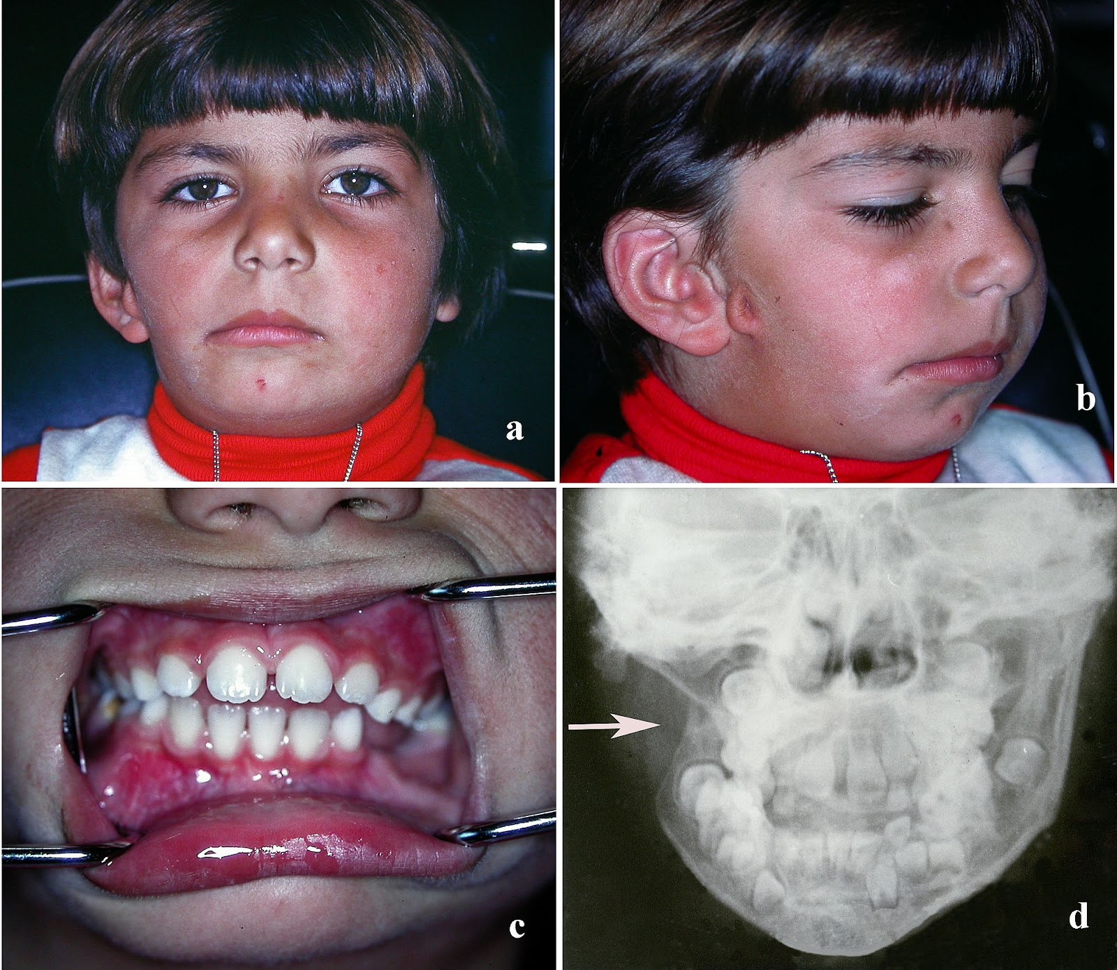 High-Yield Conditions to Know for the INBDE | INBDE Bootcamp