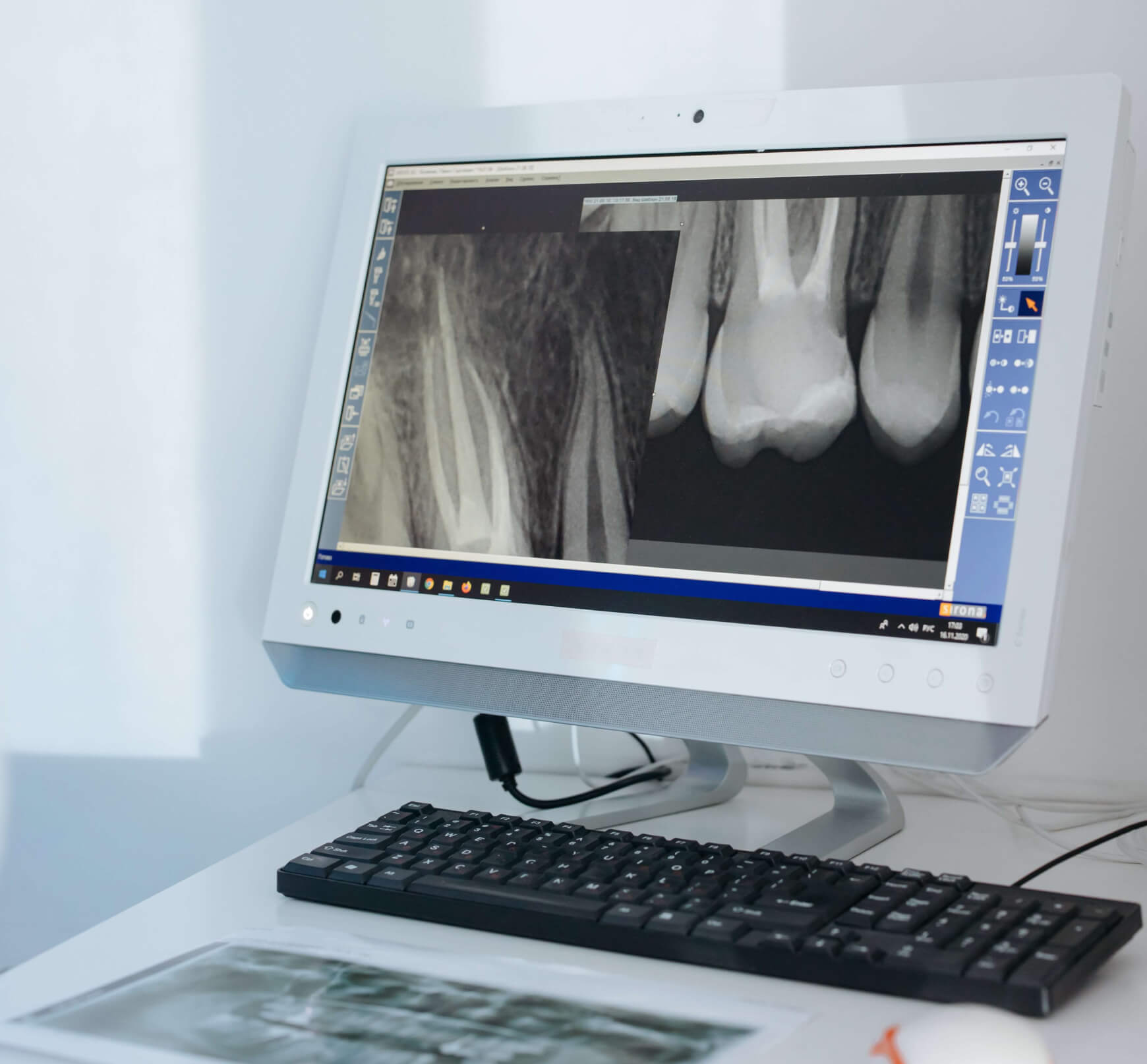 Endodontic Diagnoses to Know for the INBDE | INBDE Bootcamp