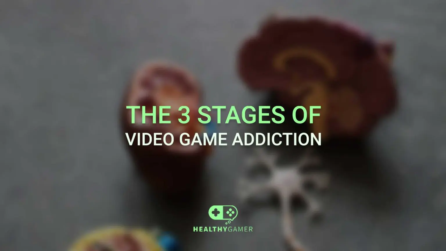 Stages of Video Game Addiction: How Bad Can it Get? | Healthy Gamer
