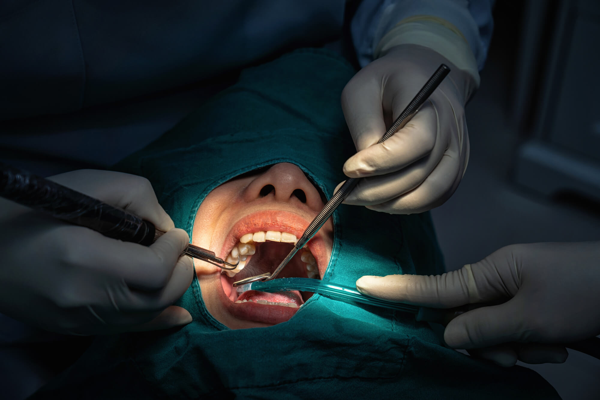 Are Dental Surgeries Safe? | Texas Oral Surgery Group Plano, TX ...