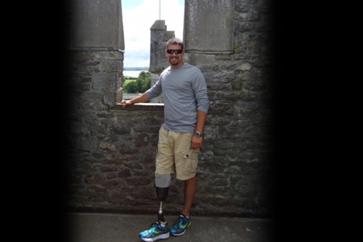 Amputee Stories & Testimonials