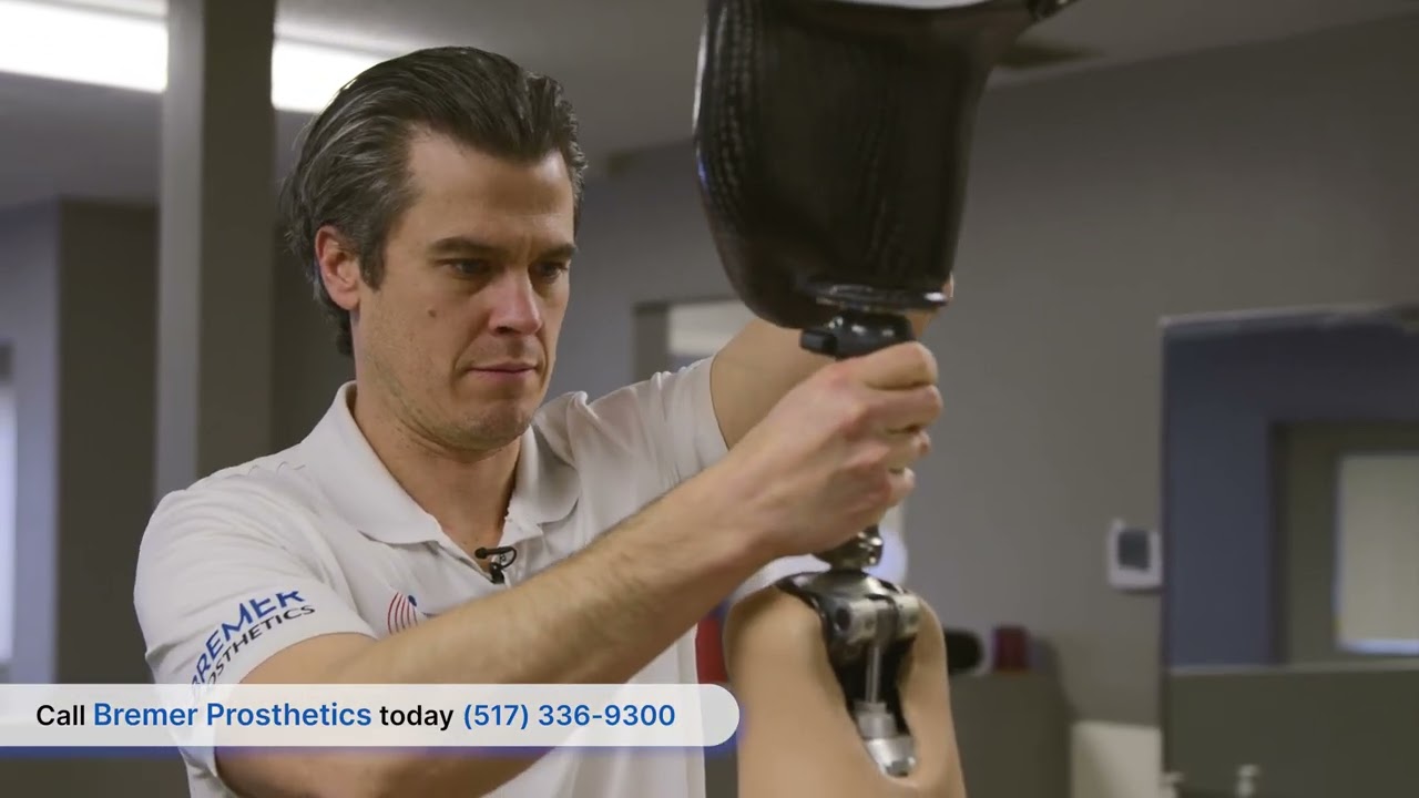 Susie's Perfect Prosthetic Fit: A Life-Changing Experience