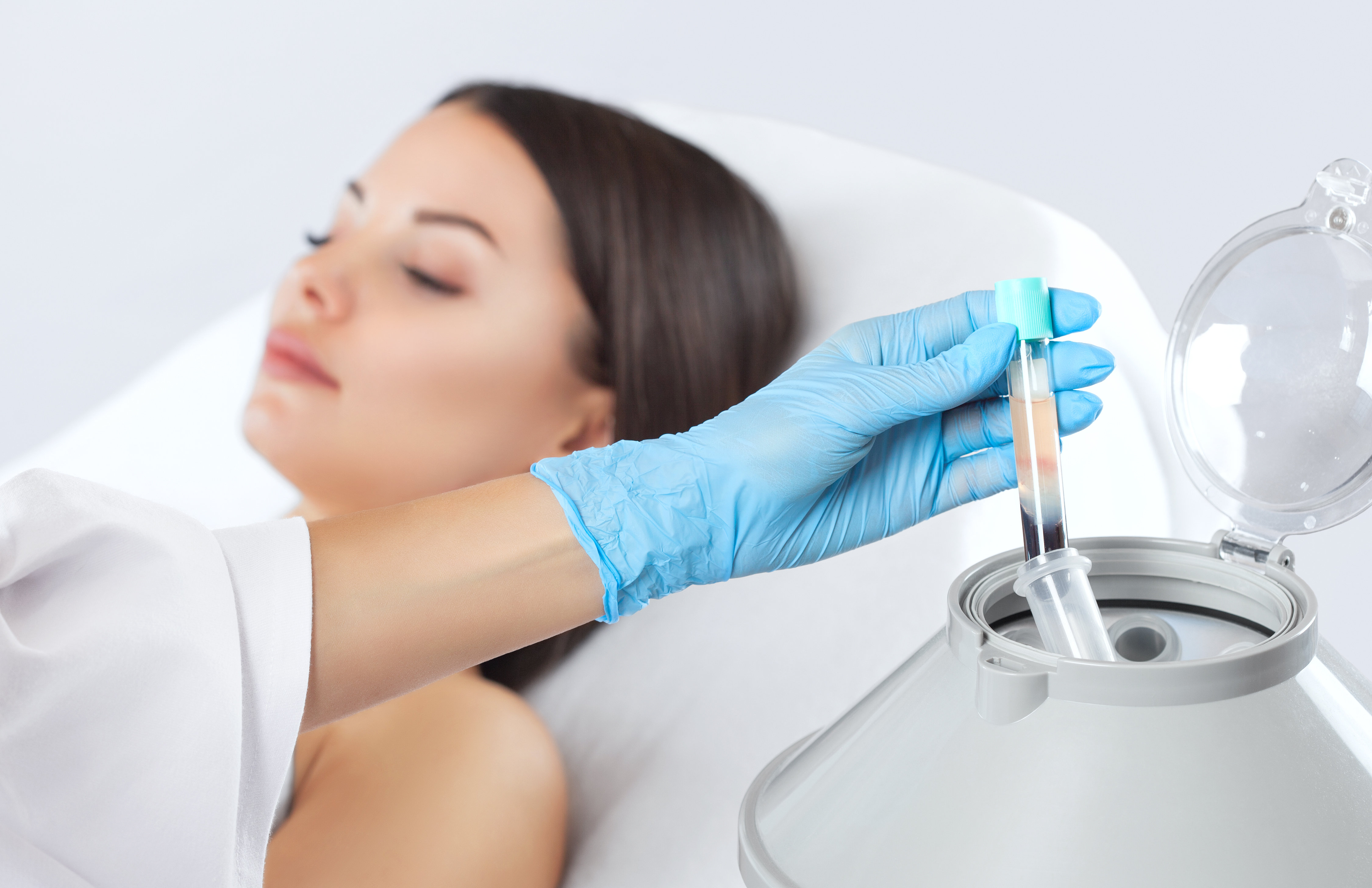 What Is PRP Therapy and Do I Need It?