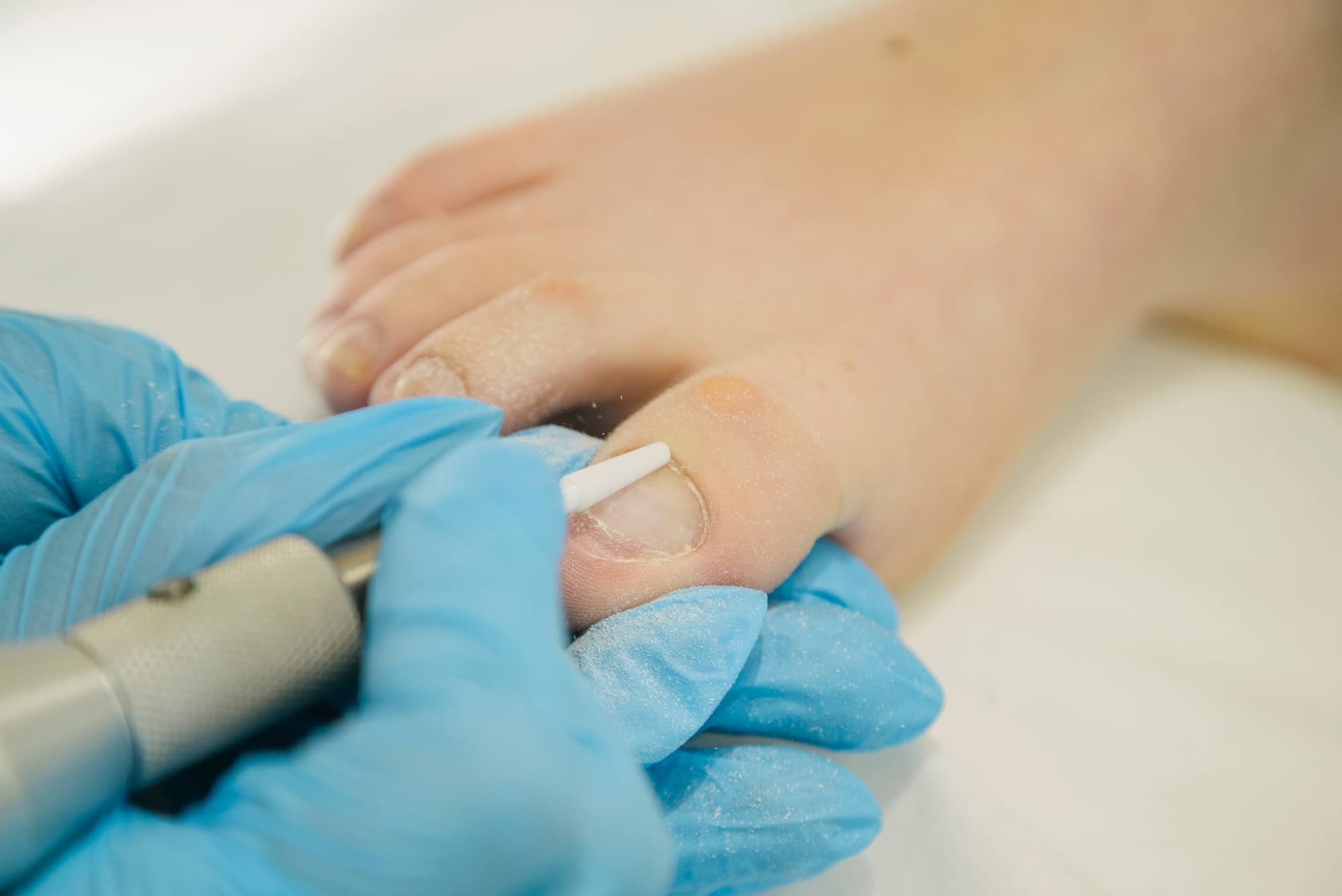 Nail Reconstruction Treatment | Nails by Toe Bro