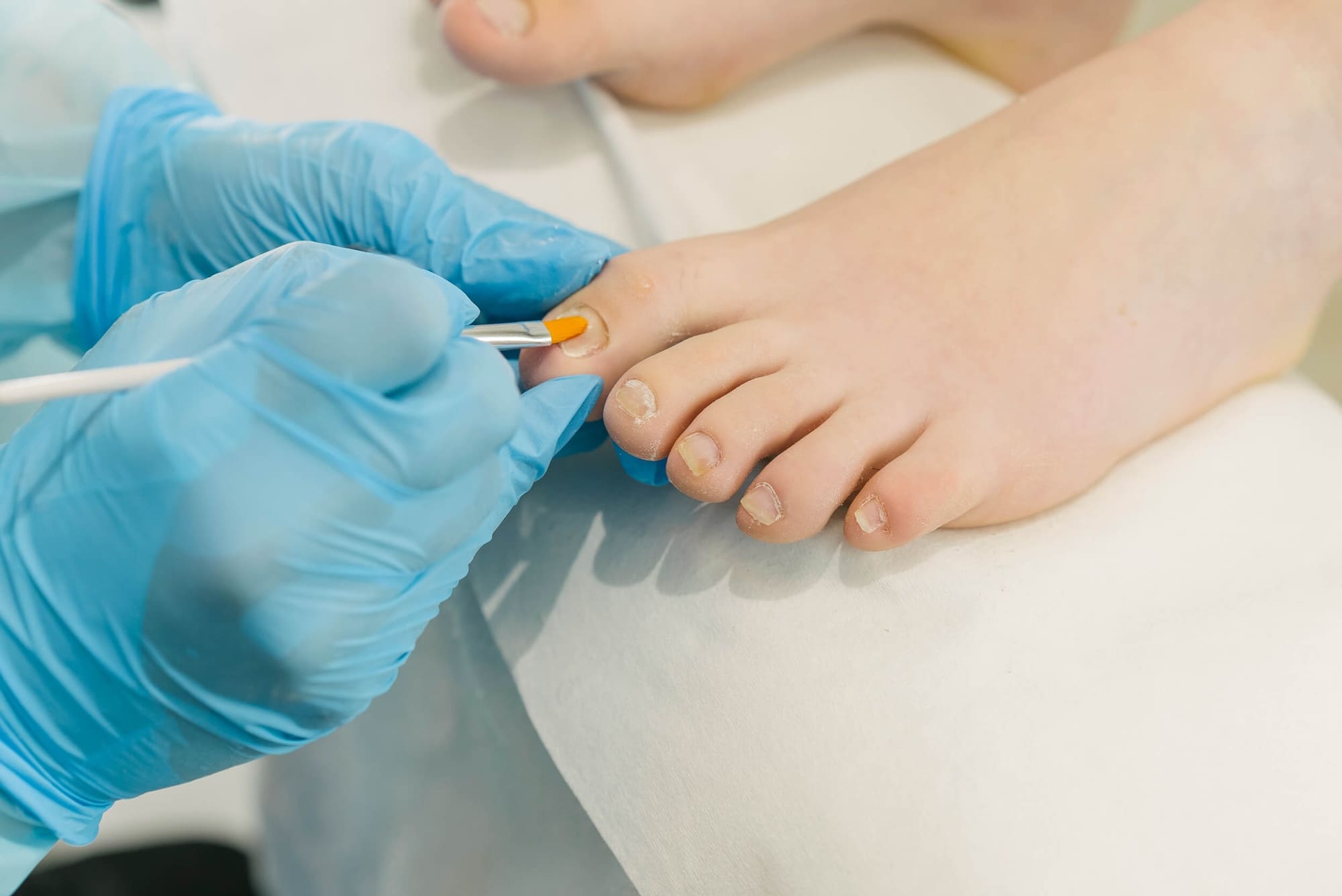 Nail Reconstruction Treatment | Nails by Toe Bro