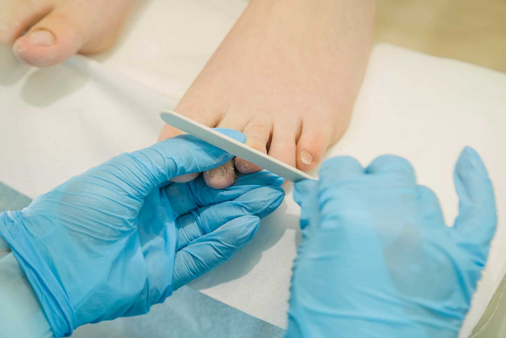 Nail Reconstruction Treatment | Nails by Toe Bro