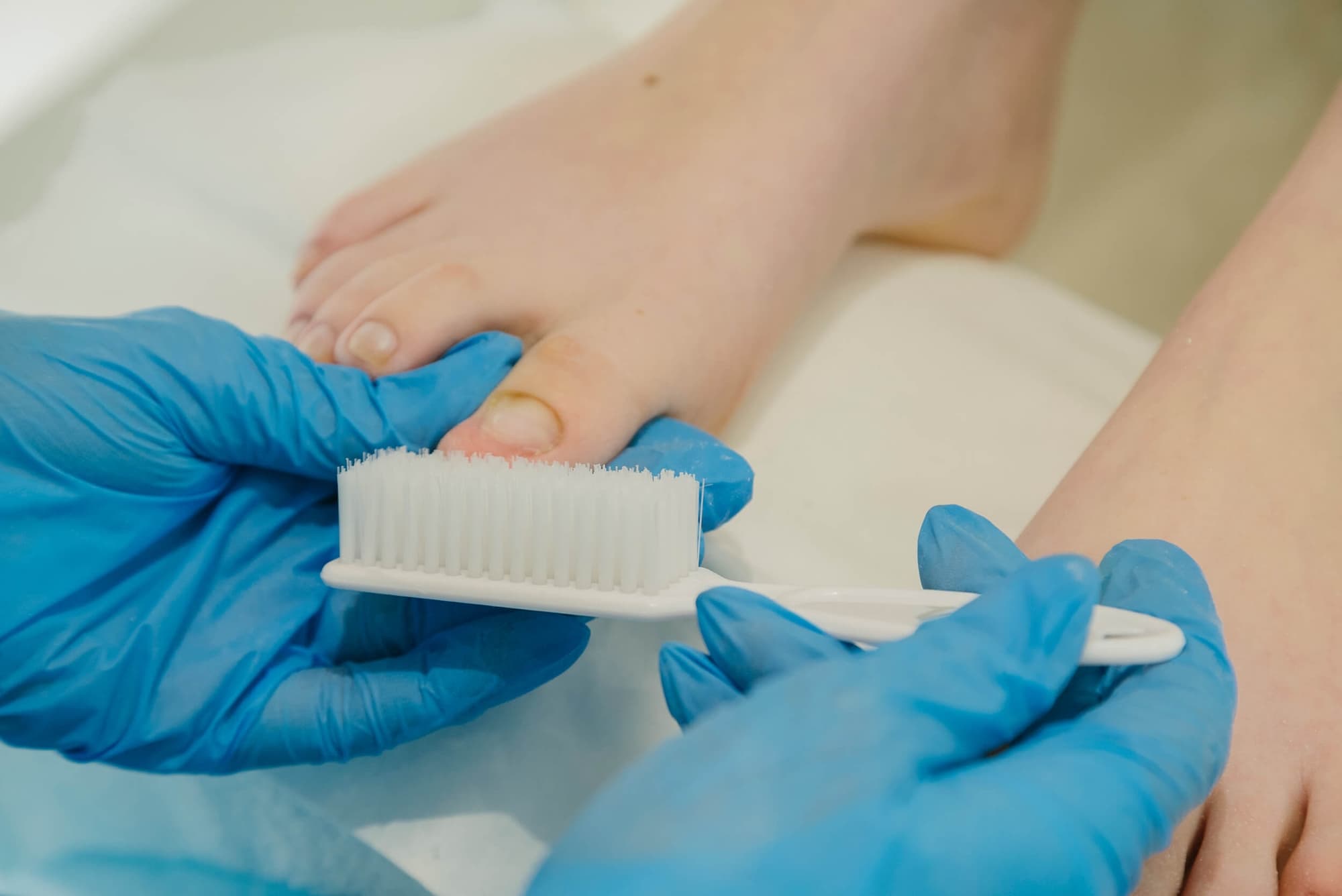 Nail Reconstruction Treatment | Nails by Toe Bro