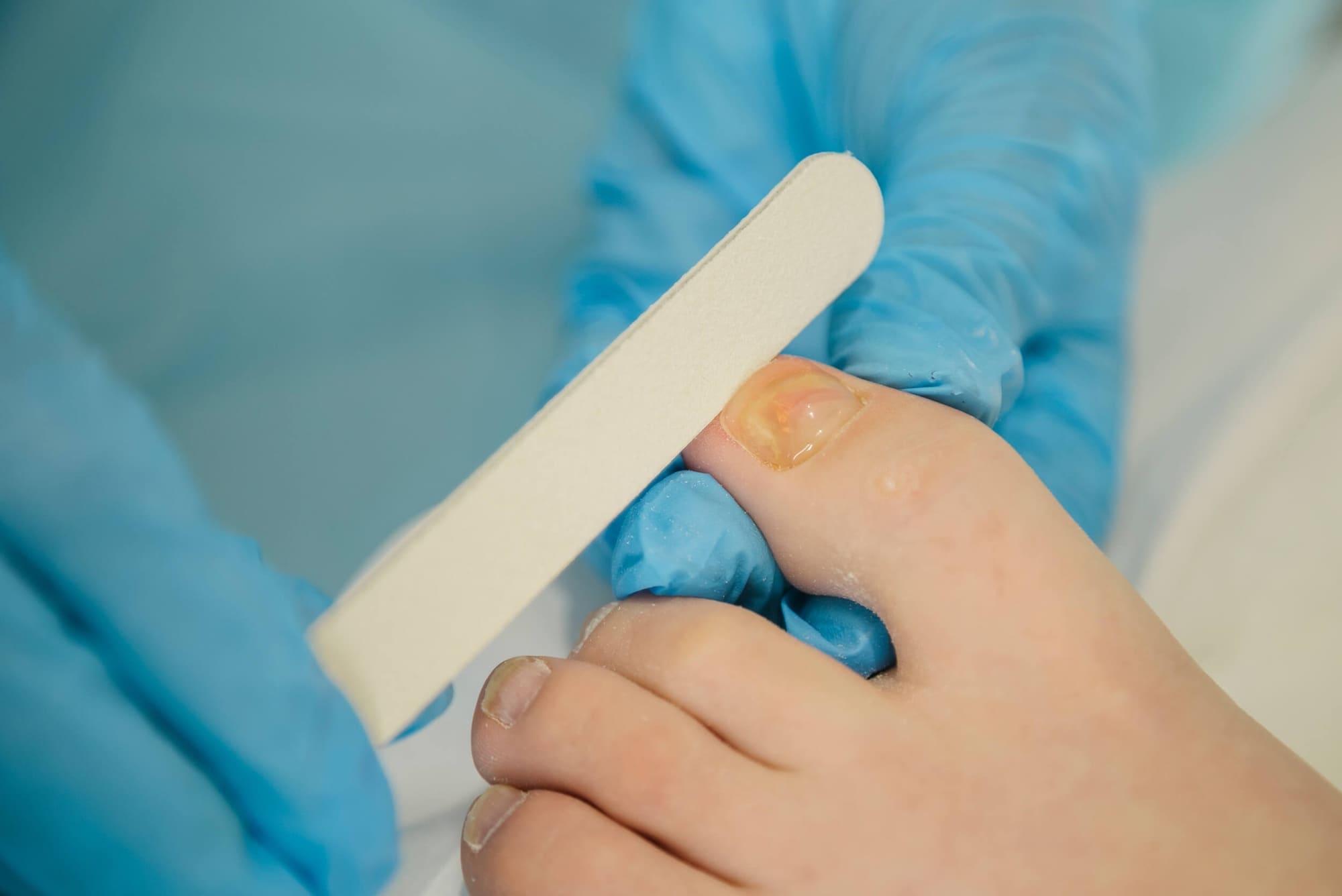 Nail Reconstruction Treatment | Nails by Toe Bro