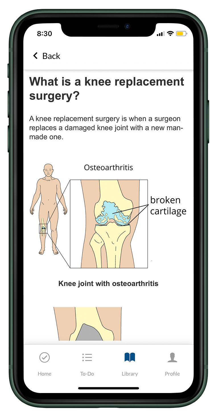 Orthopedic Digital Patient Engagement & Remote Monitoring