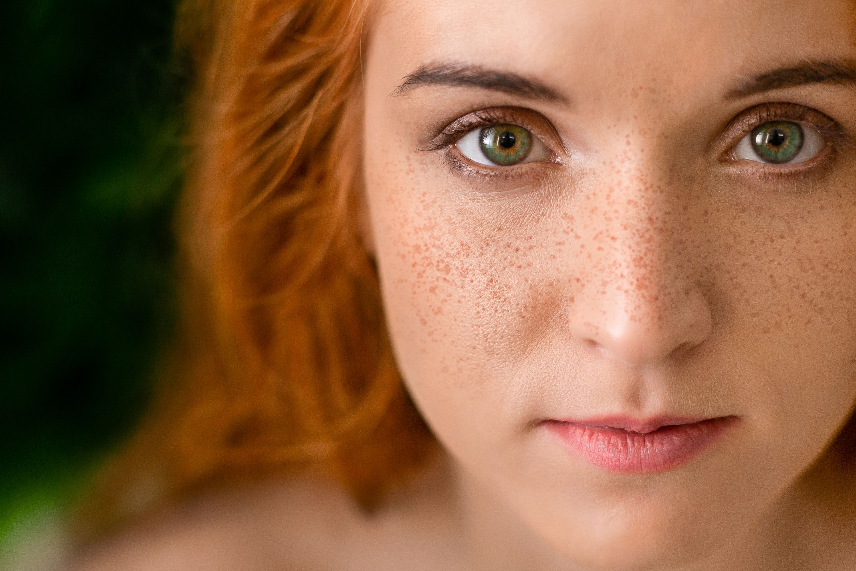 What Are Freckles? And How To Tell Them Apart From Melasma - Strut Blog