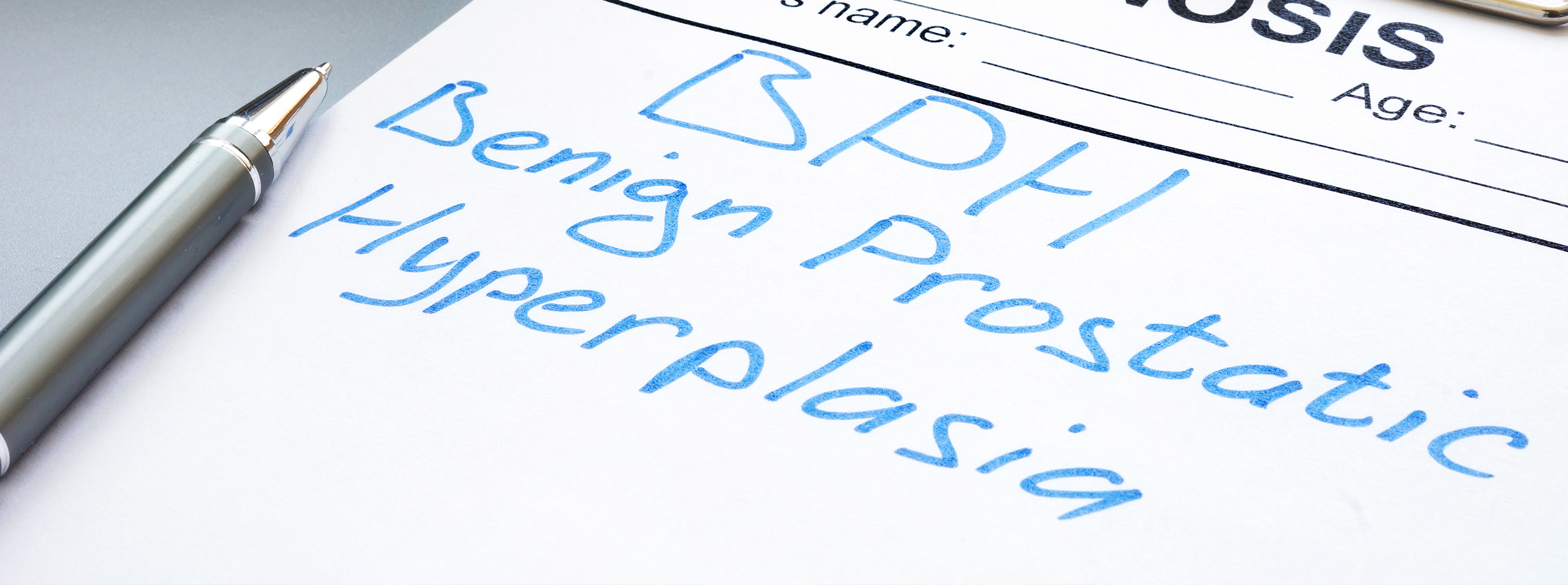 Cialis (Tadalafil) for BPH: How it Works - Strut Blog