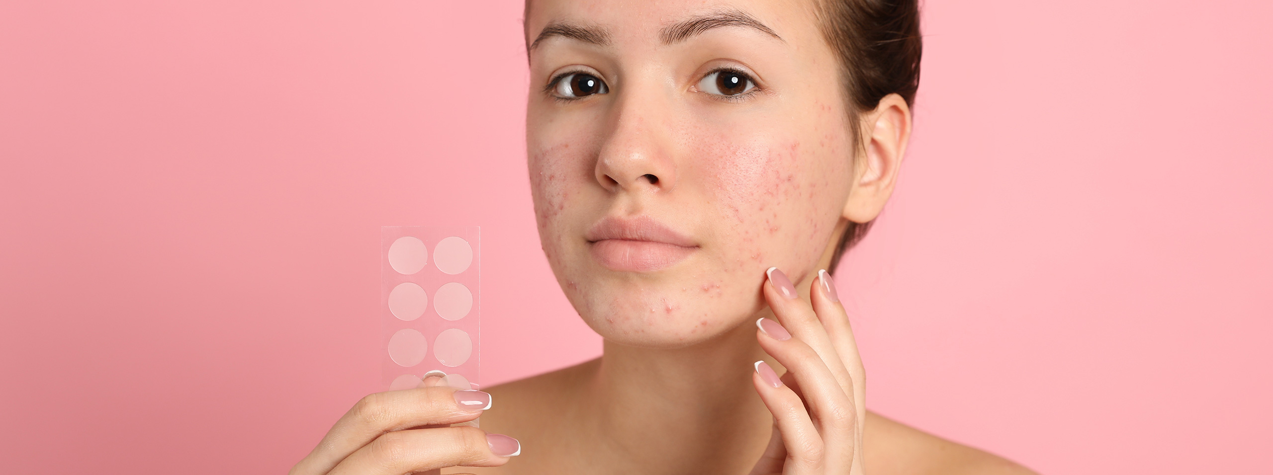 What Are Acne Patches And How To Use Them - Strut Blog