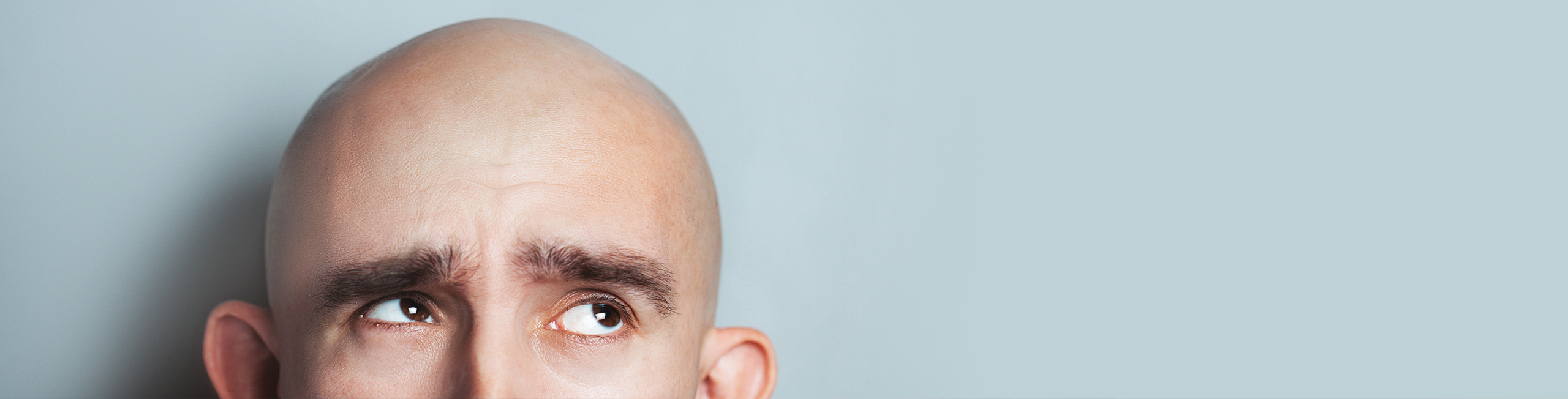 Male Balding Genetics: Where Does The “Balding Gene” Come From? - Strut ...