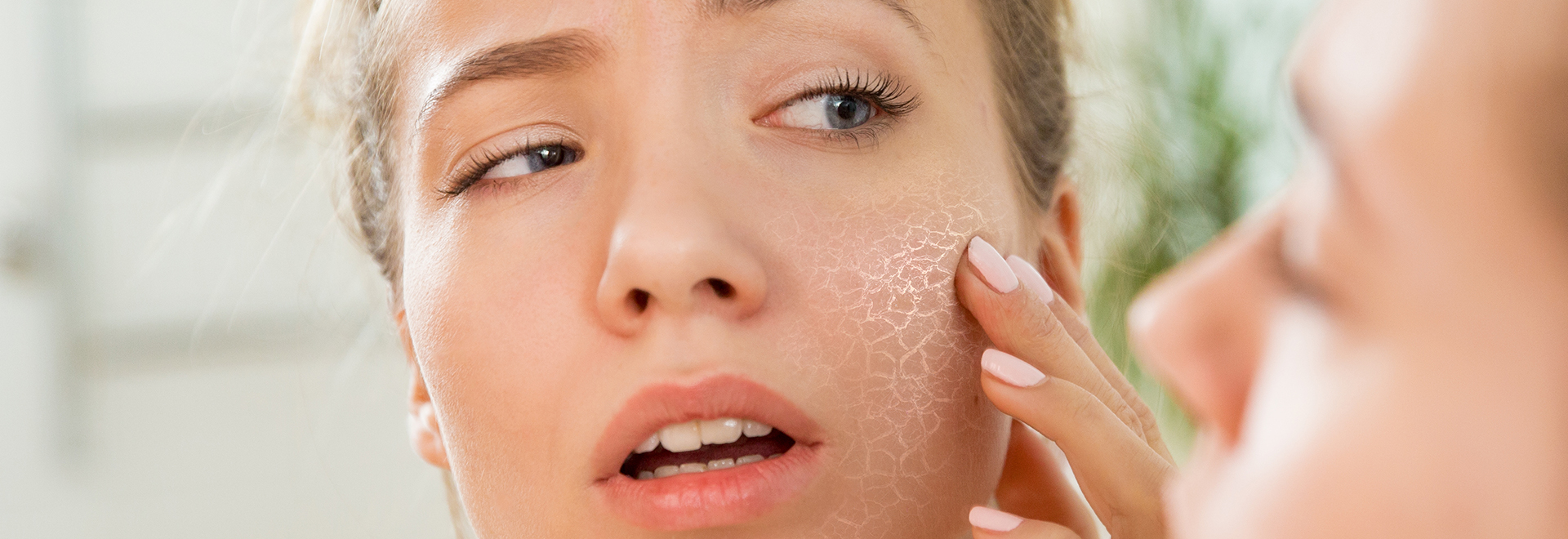  Tretinoin Peeling 5 Ways To Minimize Ugly Tretinoin Peeling Strut Blog
