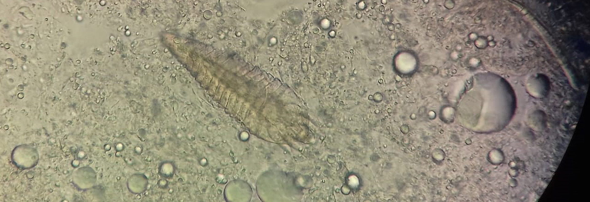 Demodex Mites & Rosacea: The Microbes Linked To Rosacea - Strut Blog