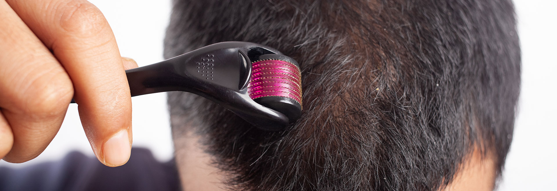Using a Dermaroller on Your Scalp?: 12 Things To Avoid - Strut Blog