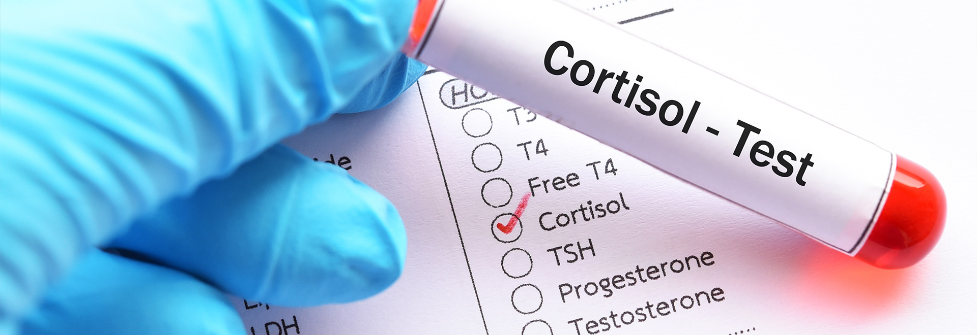 At-Home Cortisol Test: Where To Buy and How To Use - Strut Blog