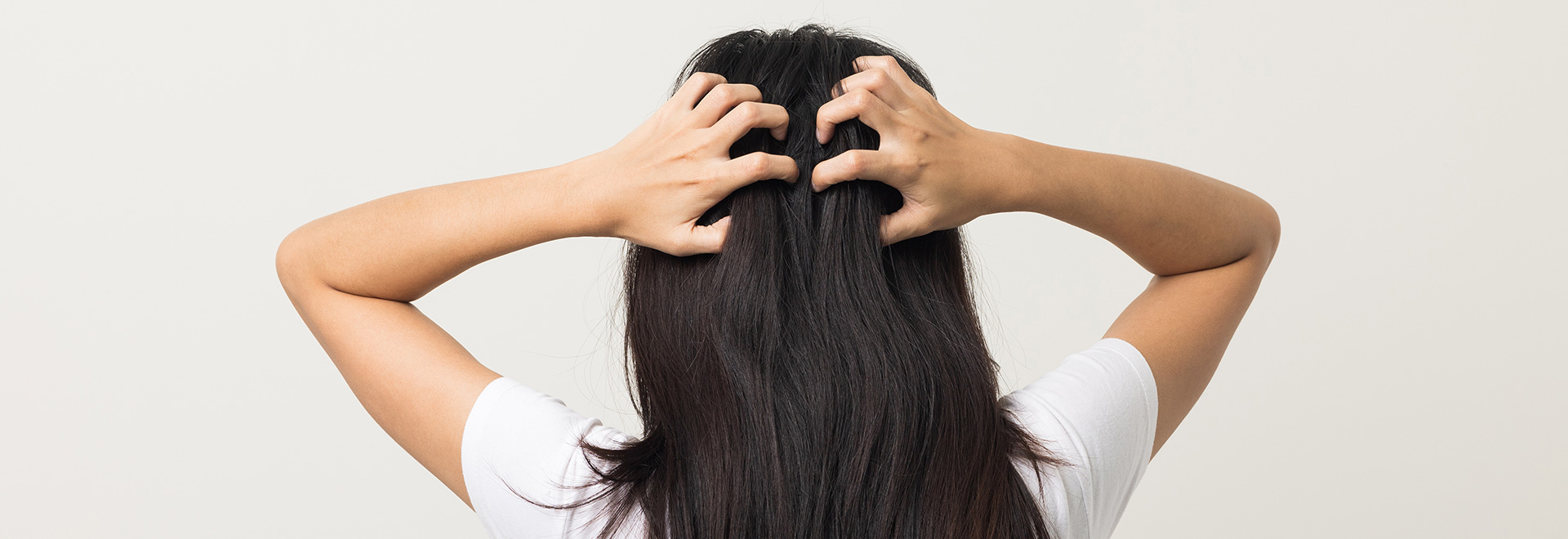 Seborrheic Dermatitis Hair Loss: Why This Can Happen and What To Do ...