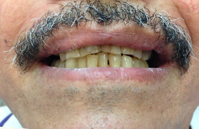 Colorado Springs Dentist | Alliance Family Dentistry