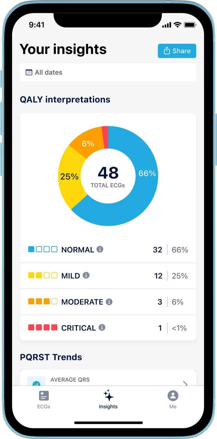 Qaly | ECG Reader - 300,000+ ECGs Analyzed