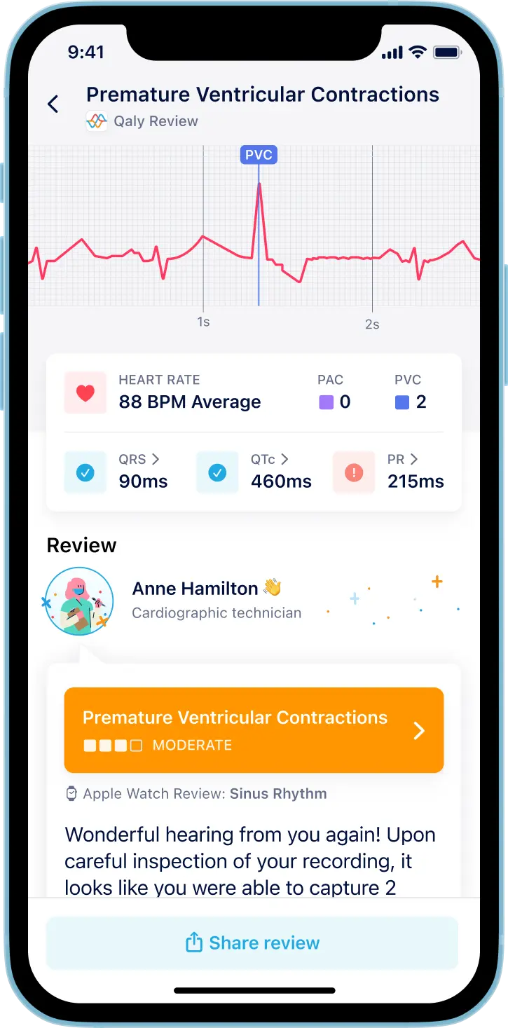 Qaly | ECG Reader - 300,000+ ECGs Analyzed