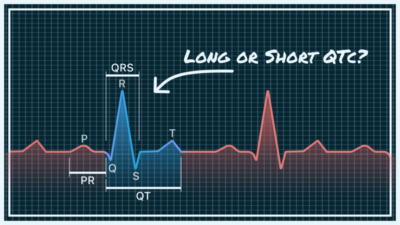 QTc Interval on Your Watch ECG - Short, Normal, and Prolonged | Qaly