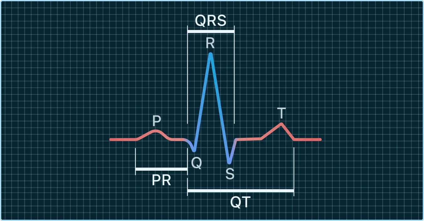 What PR, QRS, and QTc Intervals Mean on Your Watch ECG | Qaly