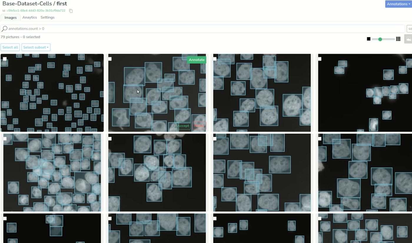 How to Use Computer Vision in Cancer Research With MLOps — Picsellia