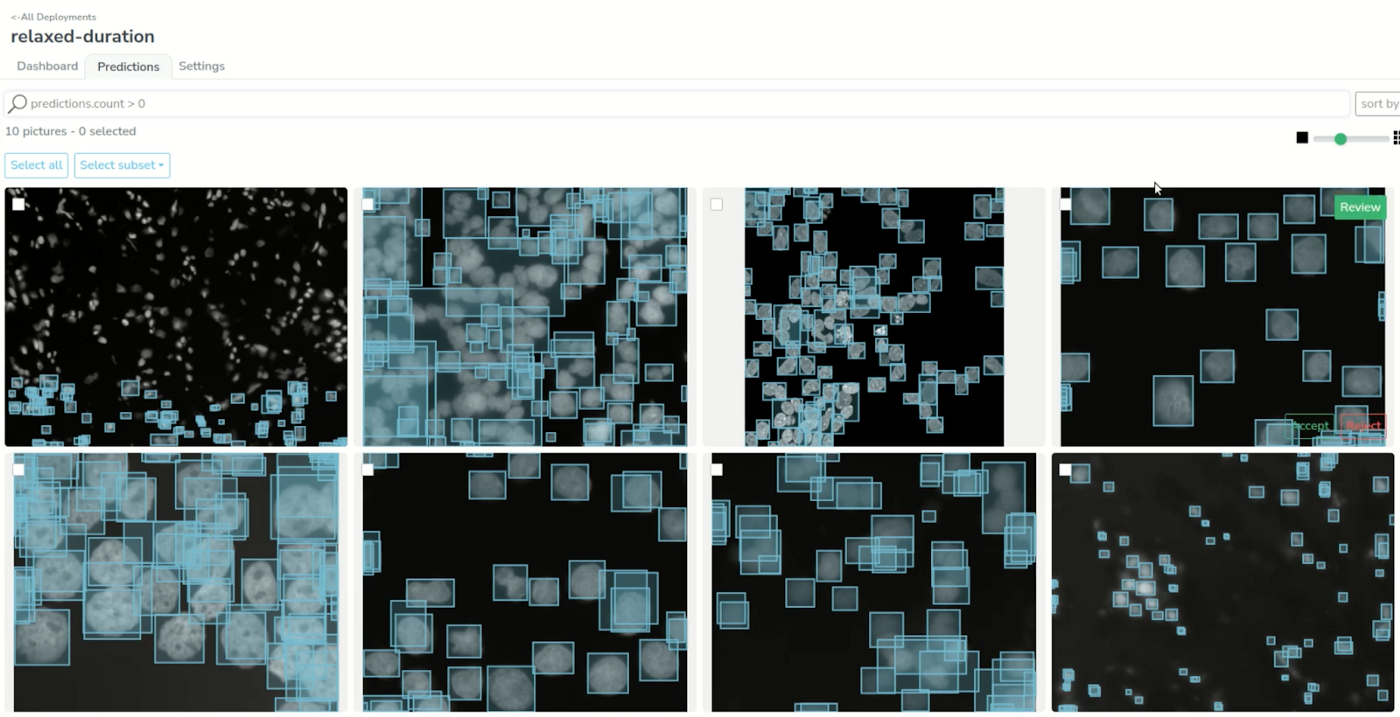 How to Use Computer Vision in Cancer Research With MLOps — Picsellia