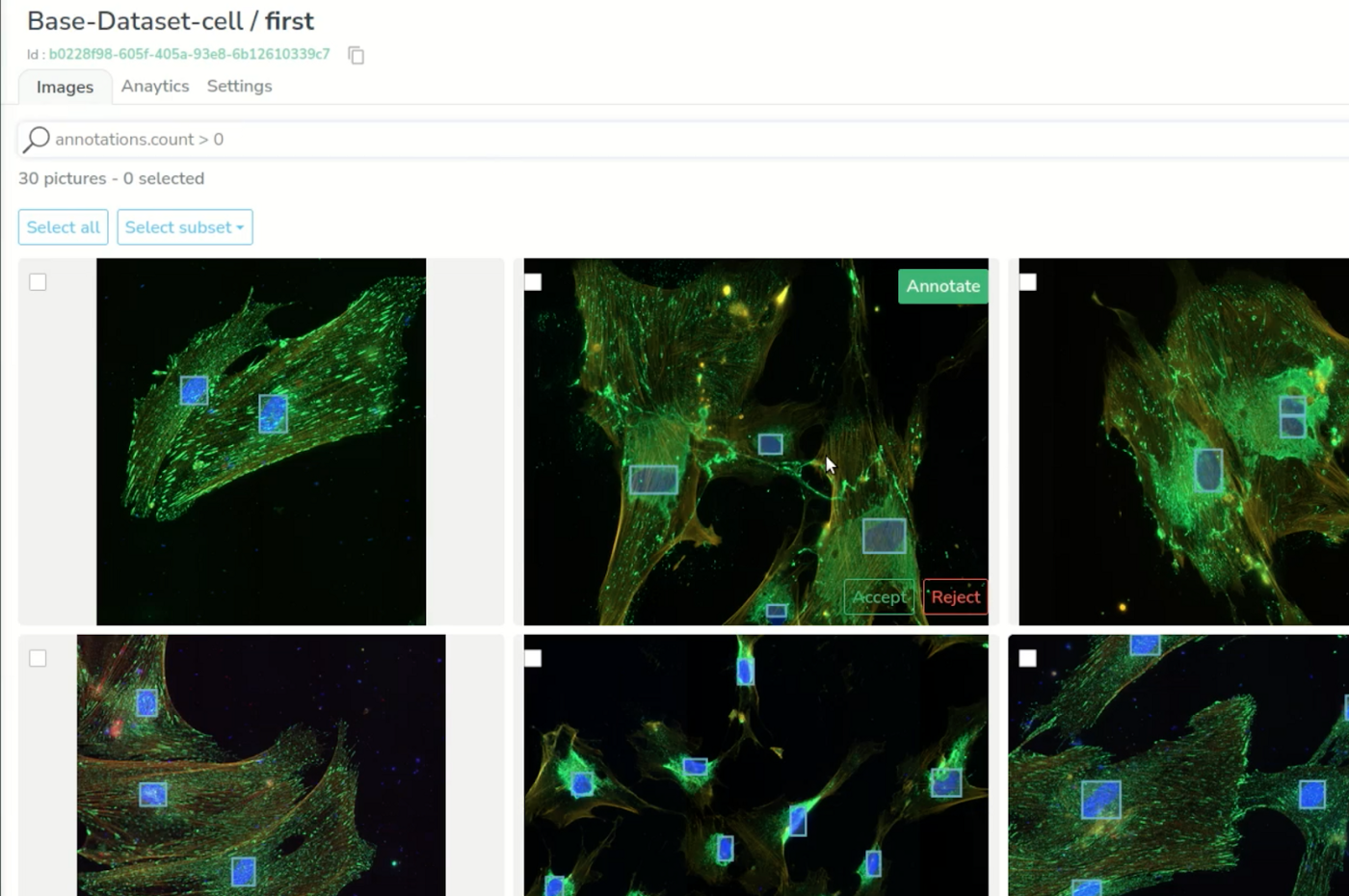 How to Use Computer Vision in Cancer Research With MLOps — Picsellia