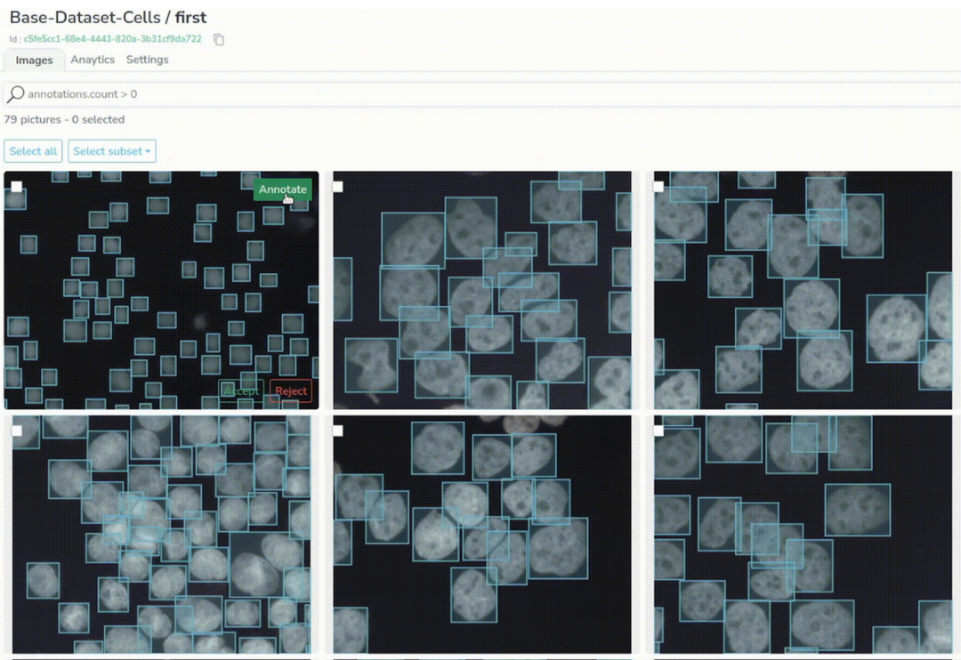 How to Use Computer Vision in Cancer Research With MLOps — Picsellia