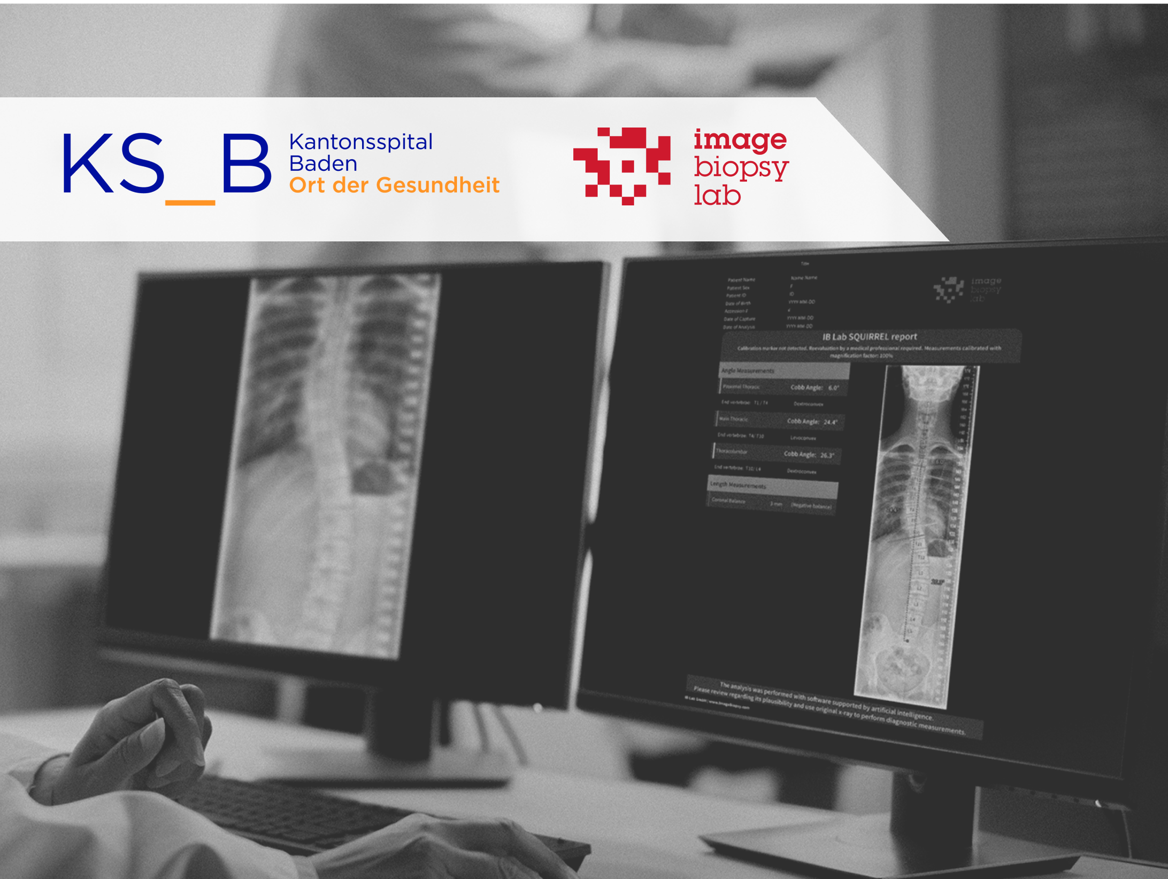 Now at Kantonsspital Baden in Switzerland: AI-driven diagnostics by ...