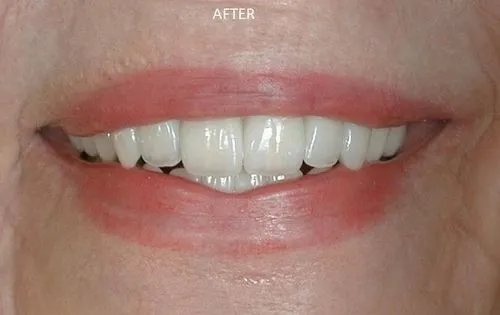 Photo Gallery 2 | Makowski Dental