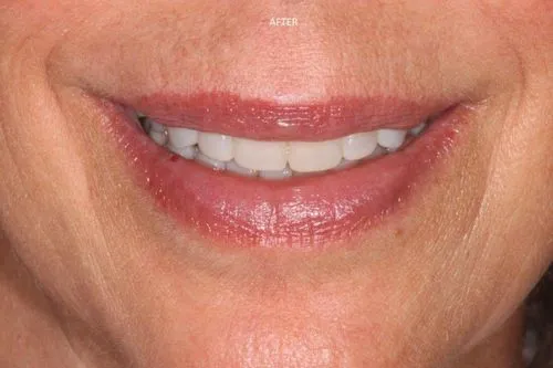 Photo Gallery 2 | Makowski Dental