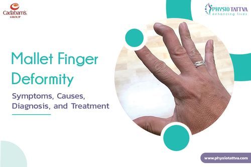 Mallet Finger: Causes, Symptoms & Effective Treatments