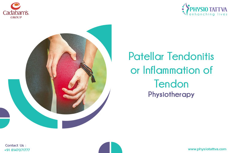 Patellar Tendonitis or Inflammation of Tendon| Physiotherapy