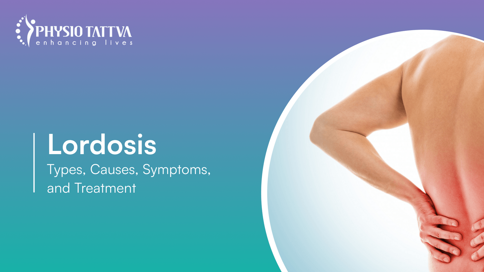 Lordosis Types Causes Symptoms And Effective Treatments