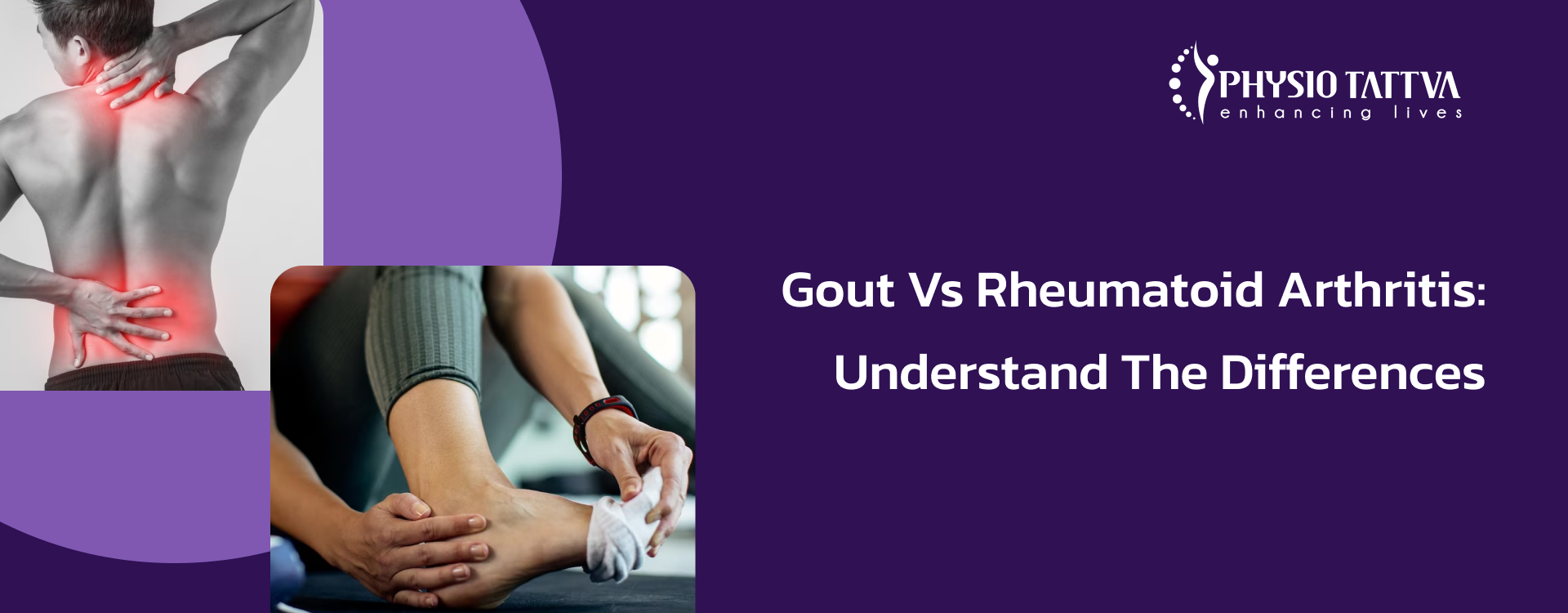 Gout vs Rheumatoid Arthritis: Understanding the Differences